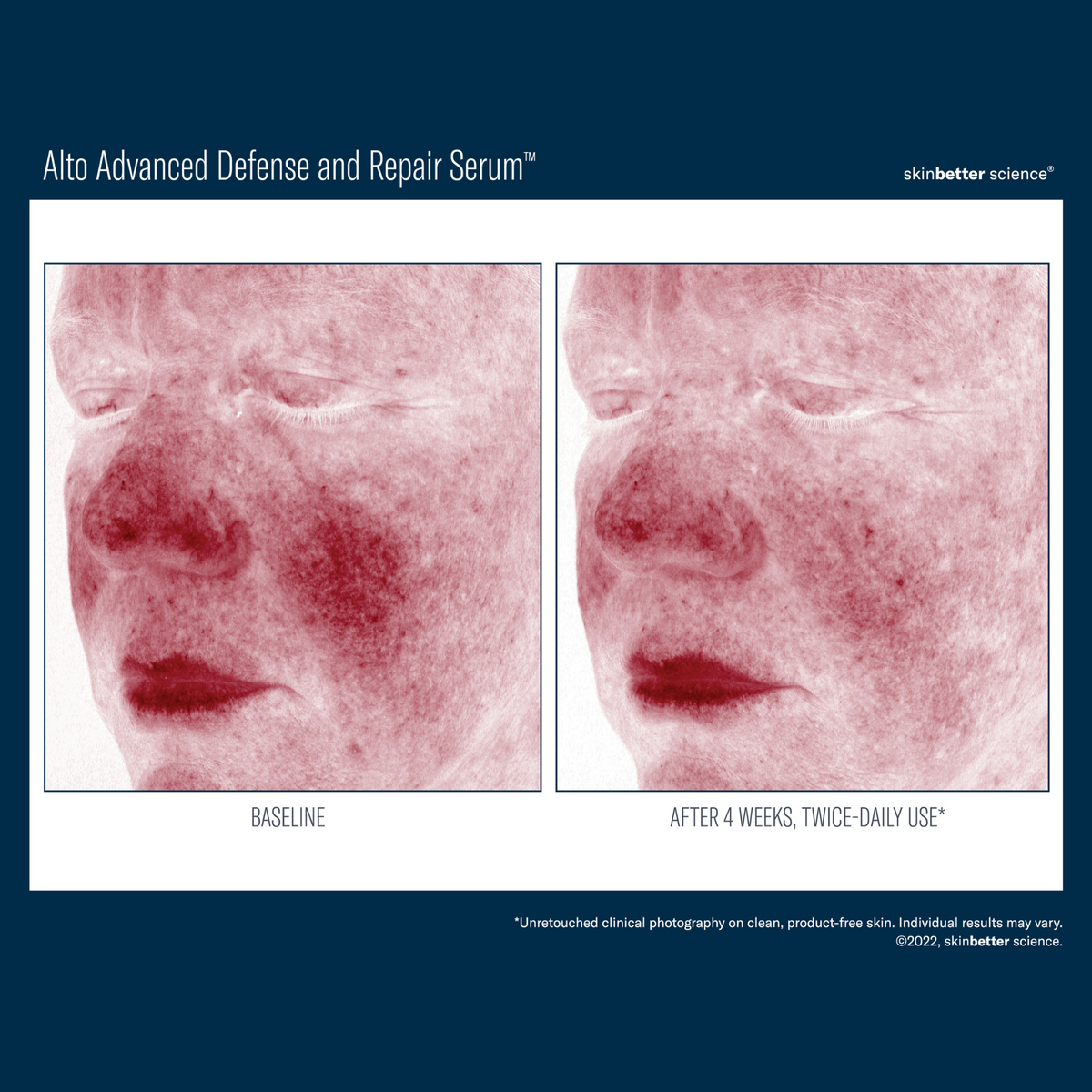 Skinbetter Alto Advanced Defense and Repair Serum – SavvyDerm