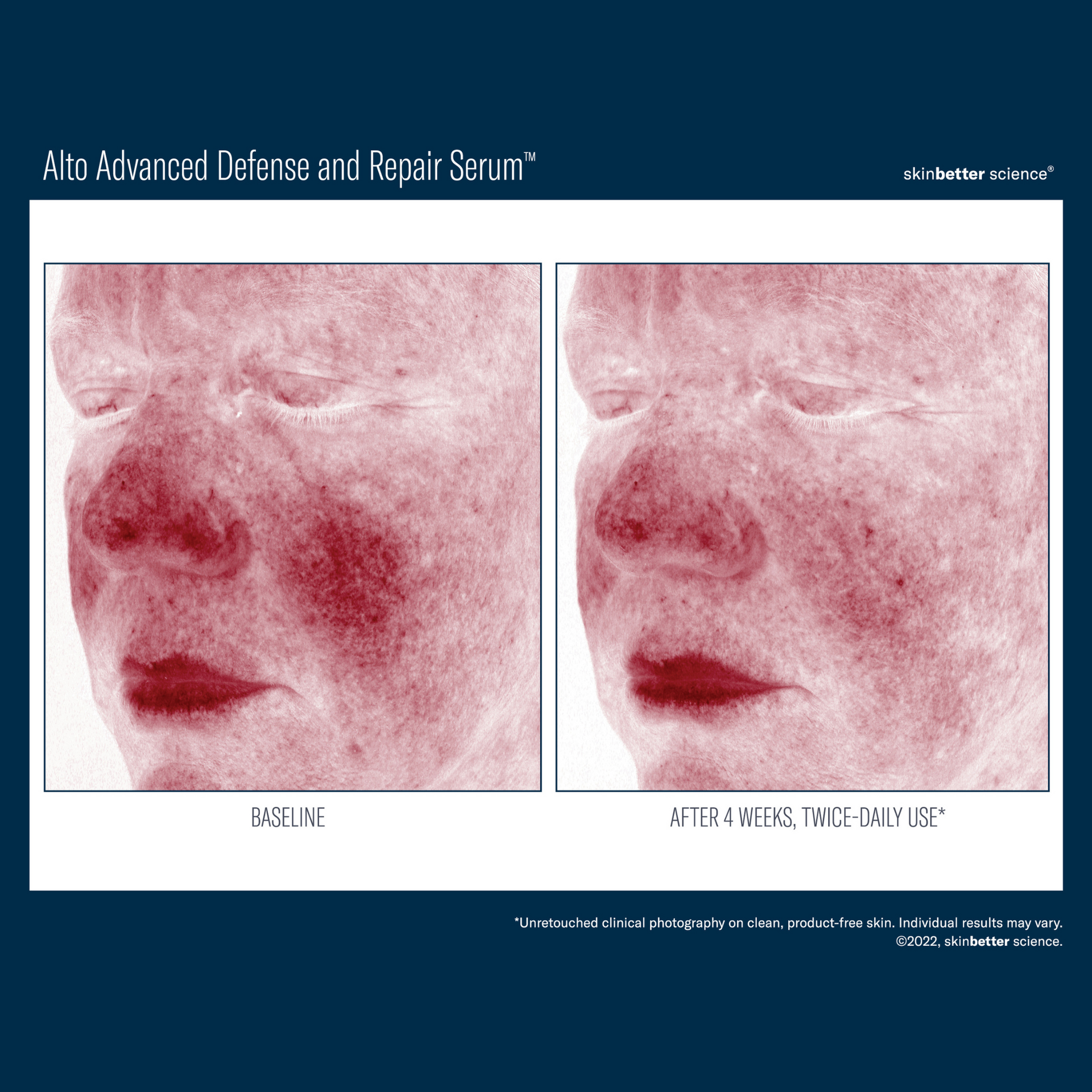 Skinbetter Alto Advanced Defense and Repair Serum – SavvyDerm
