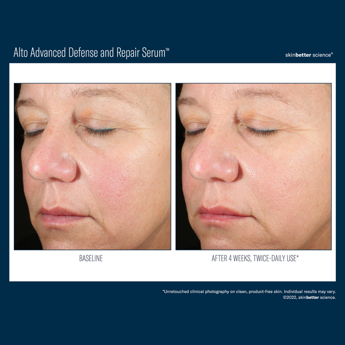 Skinbetter Alto Advanced Defense and Repair Serum – SavvyDerm
