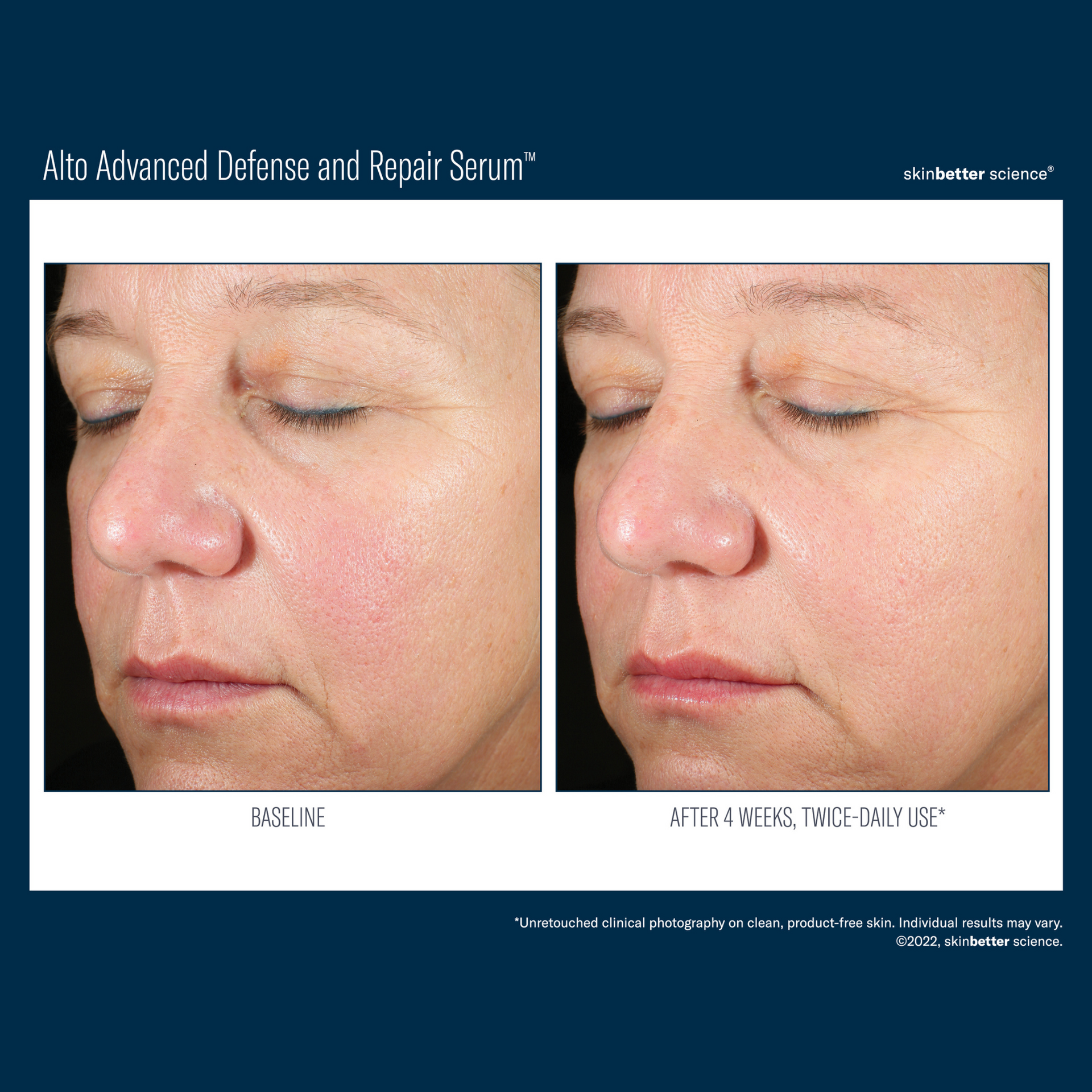 Skinbetter Alto Advanced Defense and Repair Serum – SavvyDerm