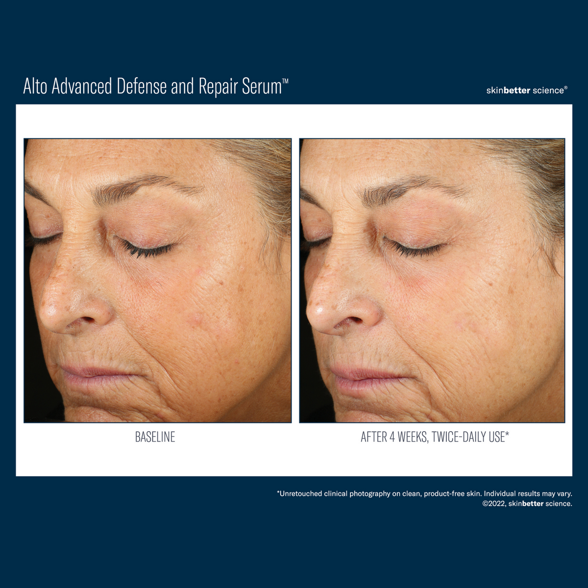 Skinbetter Alto Advanced Defense and Repair Serum – SavvyDerm