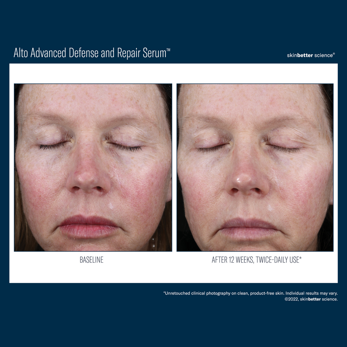 Skinbetter Alto Advanced Defense and Repair Serum – SavvyDerm