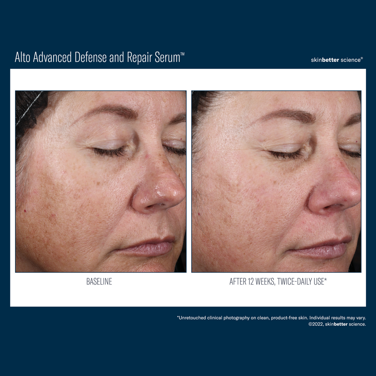 Skinbetter Alto Advanced Defense and Repair Serum – SavvyDerm